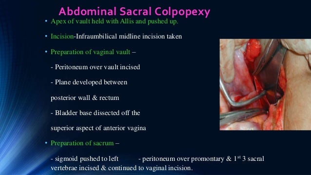 Vault prolapse, Pelvic organ Prolapse, Supports Of Uterus