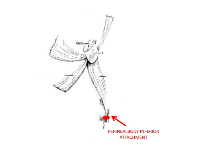 Vaginal Vault prolapse and suspension | PPTX