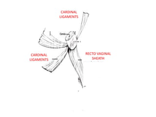 Vaginal Vault prolapse and suspension | PPTX
