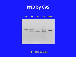 CD__PND_in_Hemophilia_A.pptx | Blood Disorders | Diseases and Conditions