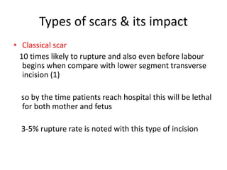 V bac discussion | PPTX