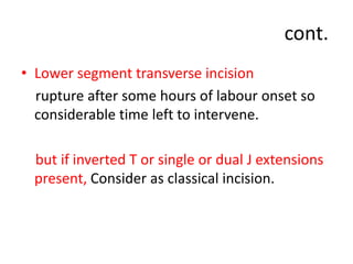 V bac discussion | PPT