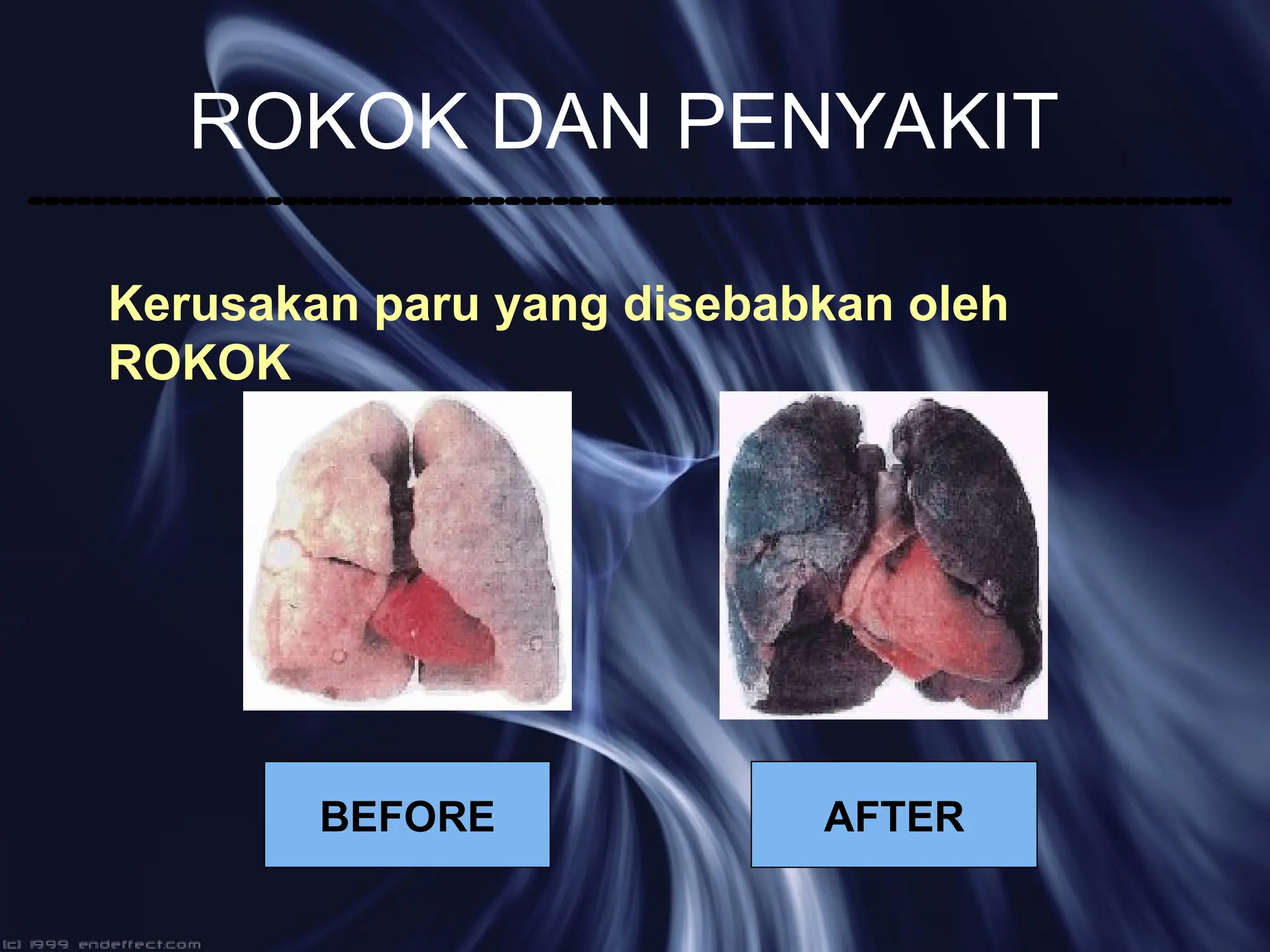 (V) BAHAYA ROKOK TERHADAP KESEHATAN,dan cara untuk berhenti merokok.ppt