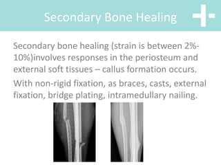 Common fractures and how to treat them | PPTX