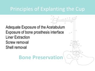 Removing Acetabular Cup | PPT