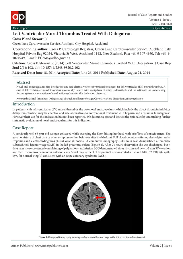 Left ventricular-mural-thrombus-treated-with-dabigatran | PDF