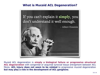 Mucoid ACL Degeneration | PDF