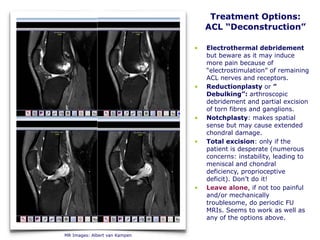 V Bobic - Mucoid ACL - ACL SG St Kitts 2023 As presented.pdf