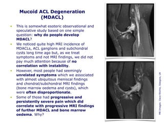 V Bobic - Mucoid ACL - ACL SG St Kitts 2023 As presented.pdf