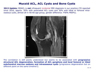 V Bobic - Mucoid ACL - ACL SG St Kitts 2023 As presented.pdf