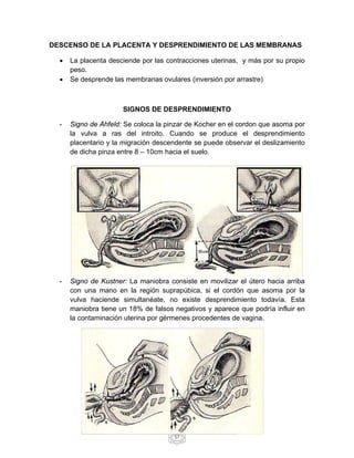 Tarjetero de conceptos en salud reproductiva | PDF