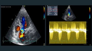 tavi_case_22_(1).pptx