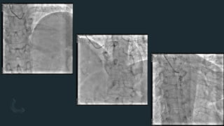 tavi_case_22_(1).pptx