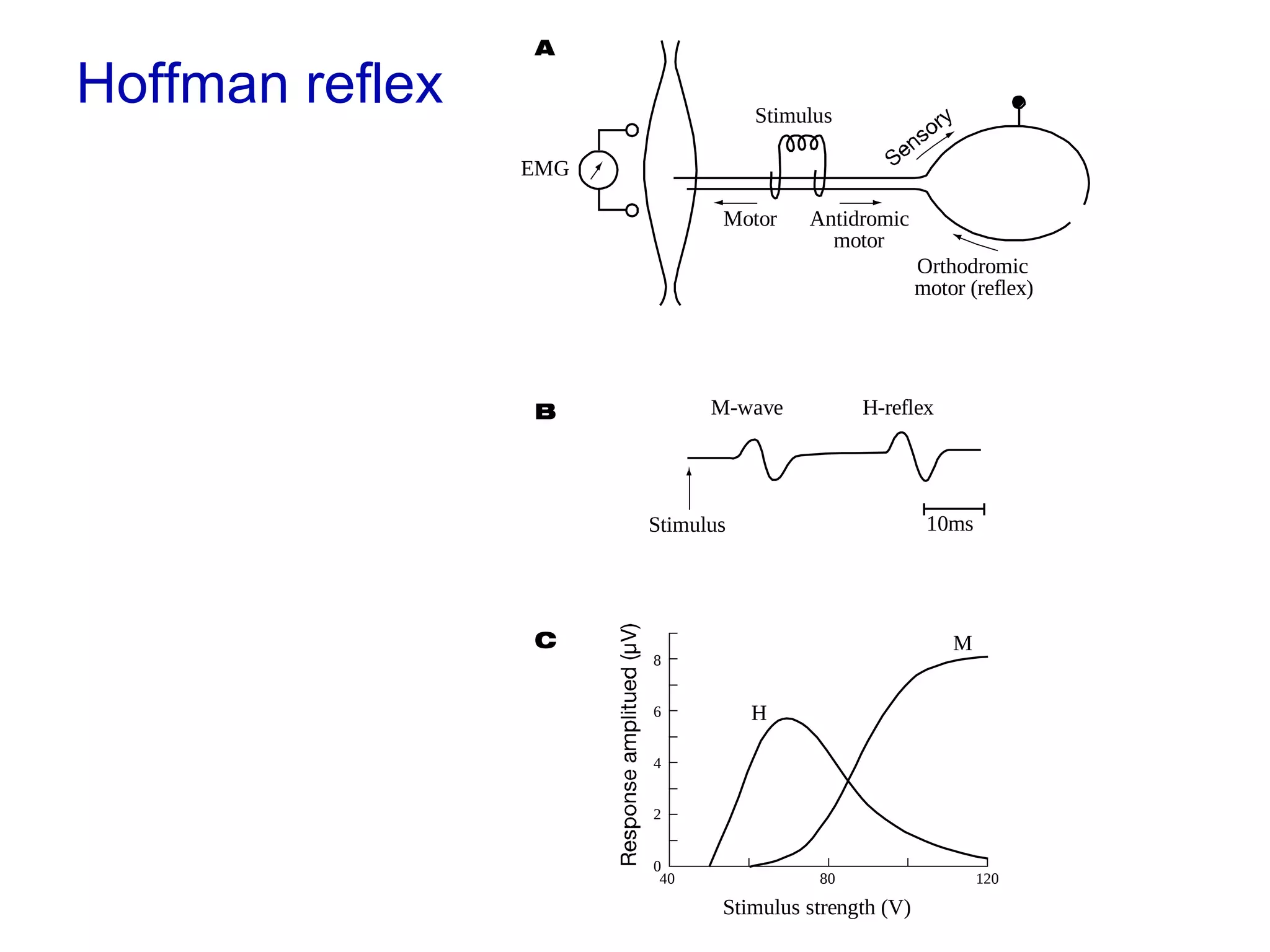 Anatomy and Physiology of Motor disorder | PPT
