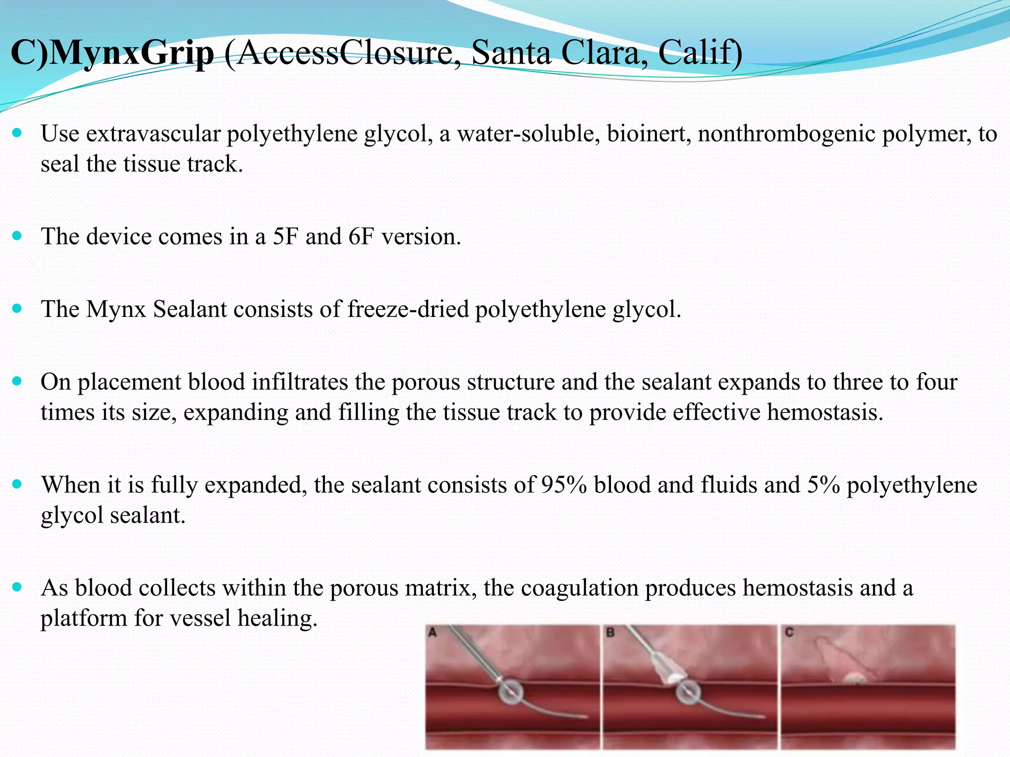 Vascular Closure Devices | PPTX