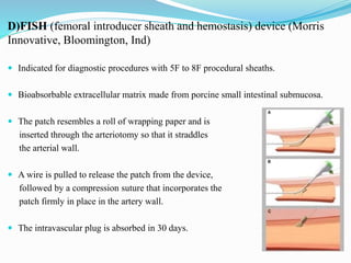 Vascular Closure Devices | PPTX