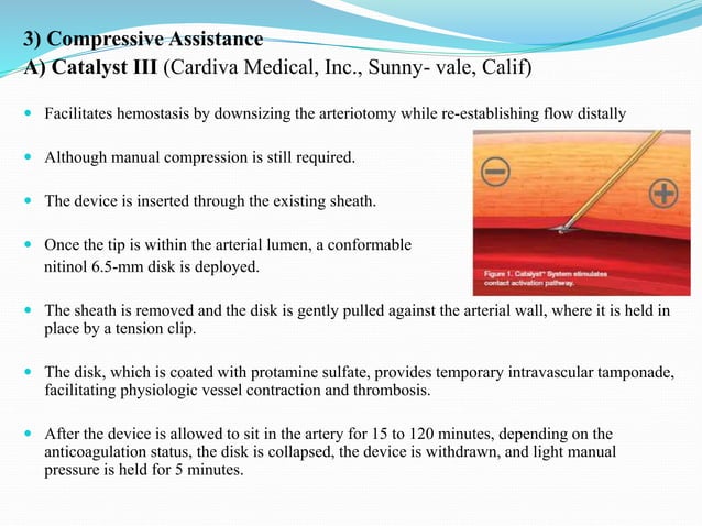 Vascular Closure Devices | PPTX | First Aid | Injuries