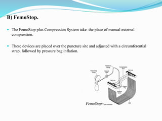 Vascular Closure Devices | PPTX