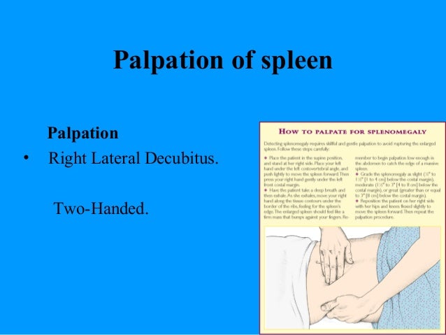 [Int. med] spleenomegaly from SIMS Lahore