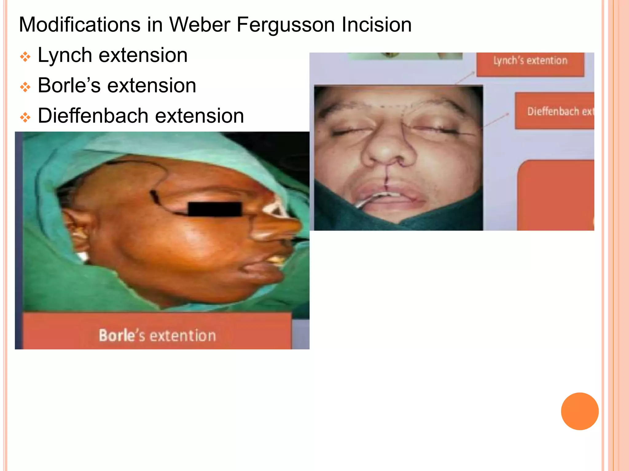 Sinunasal malignacy | PPTX