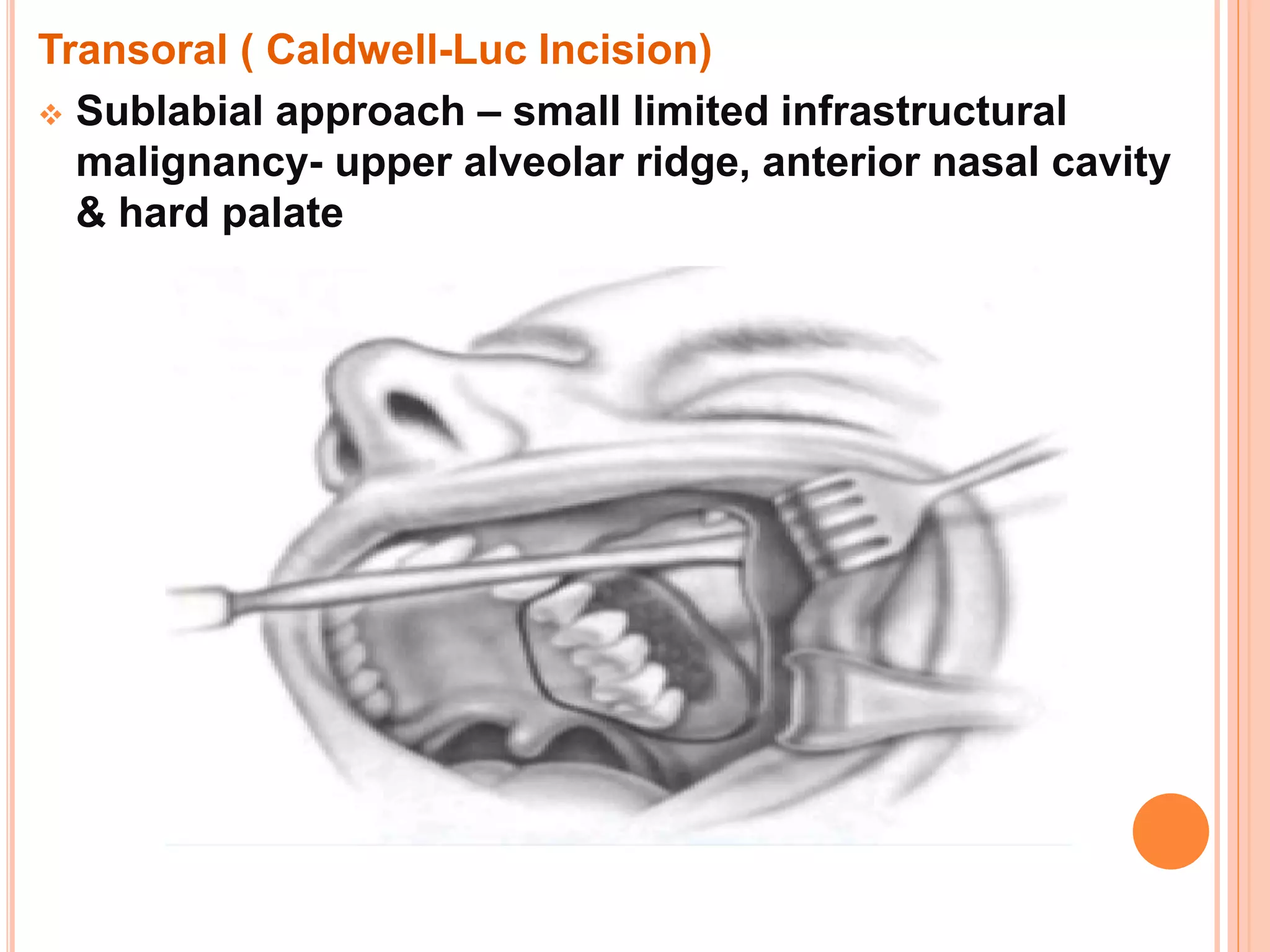 Sinunasal malignacy | PPTX