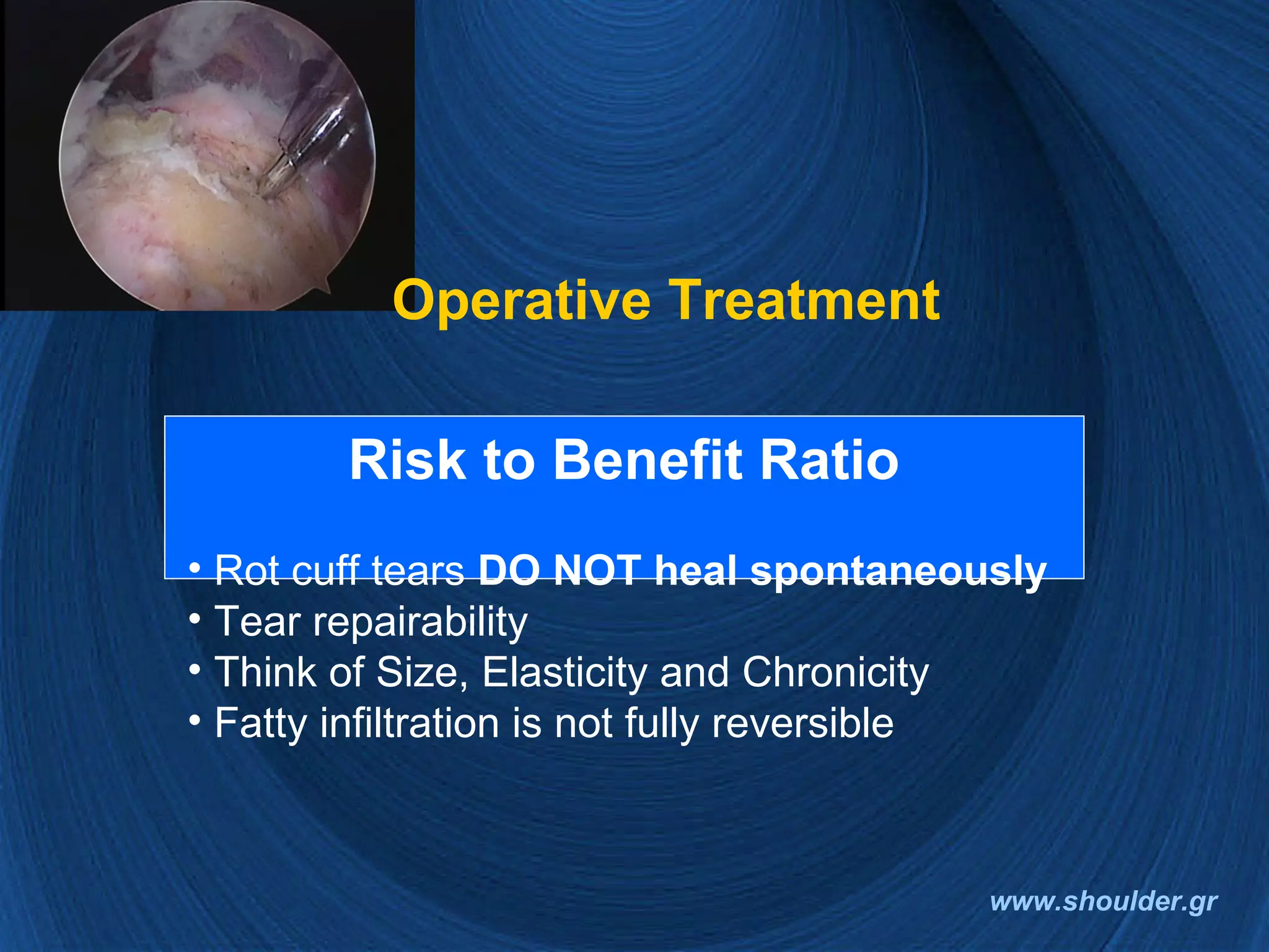 Rotator Cuff 2008 Final Ppt