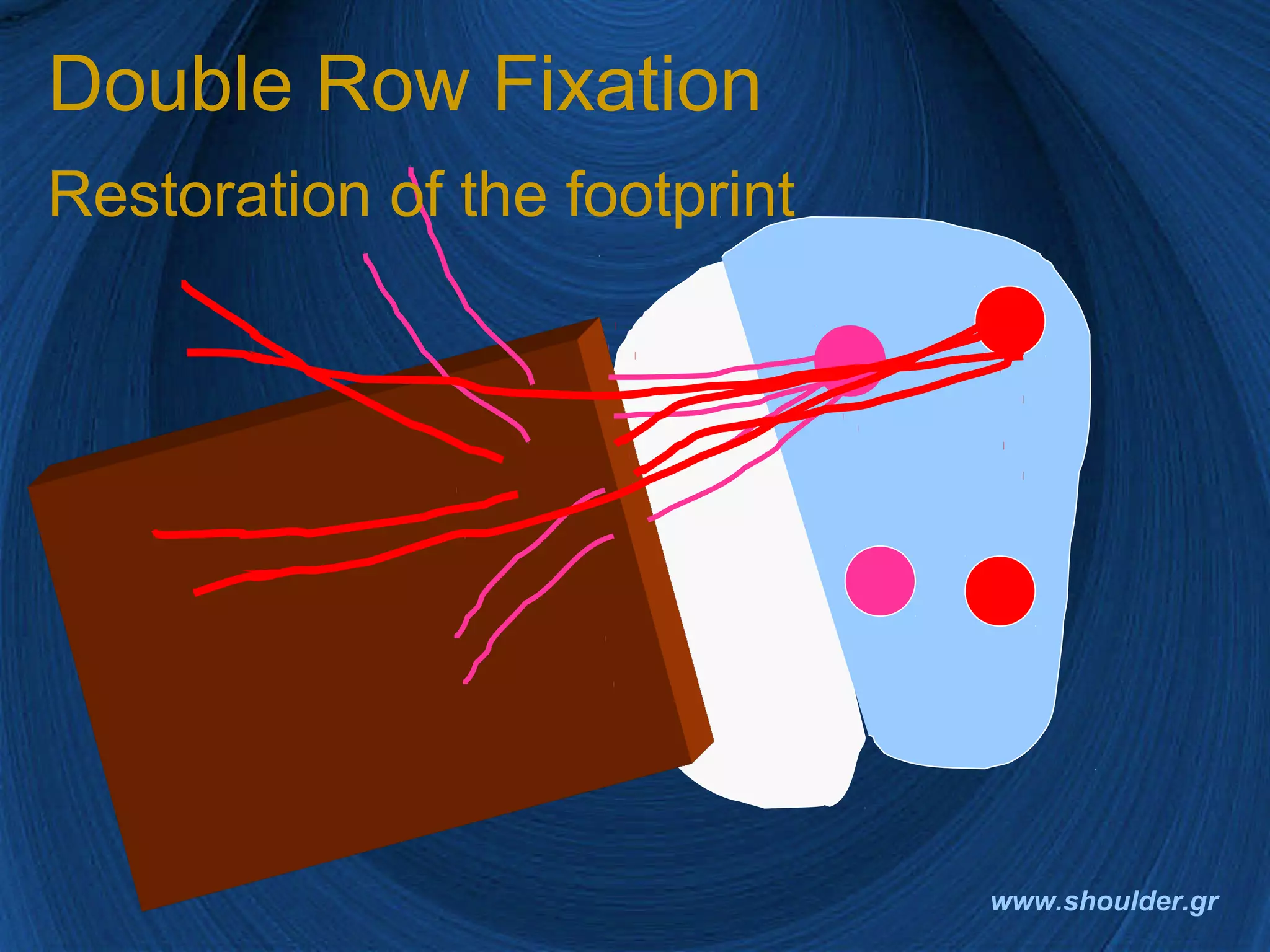 Rotator cuff 2008 final | PPT