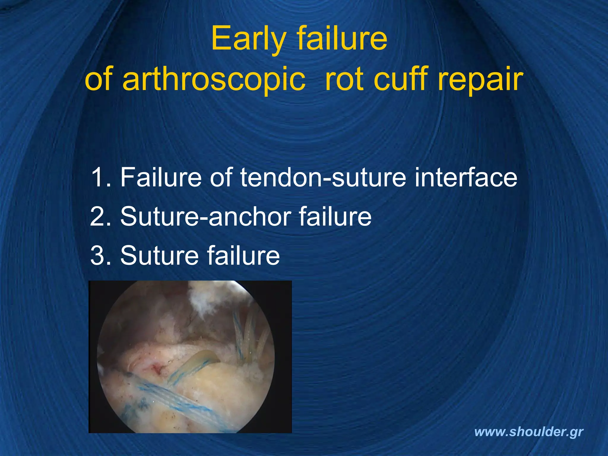 Rotator cuff 2008 final | PPT