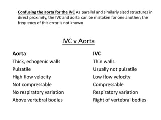 vdocument.in_ivc-ultrasound.pptx