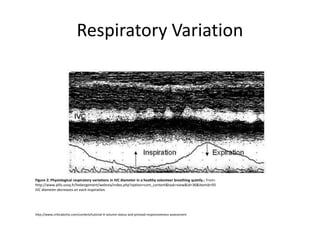 vdocument.in_ivc-ultrasound.pptx