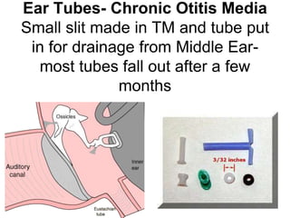 vdocument.in_anatomy-and-physiology-of-the-ear-568c2164801fc.ppt