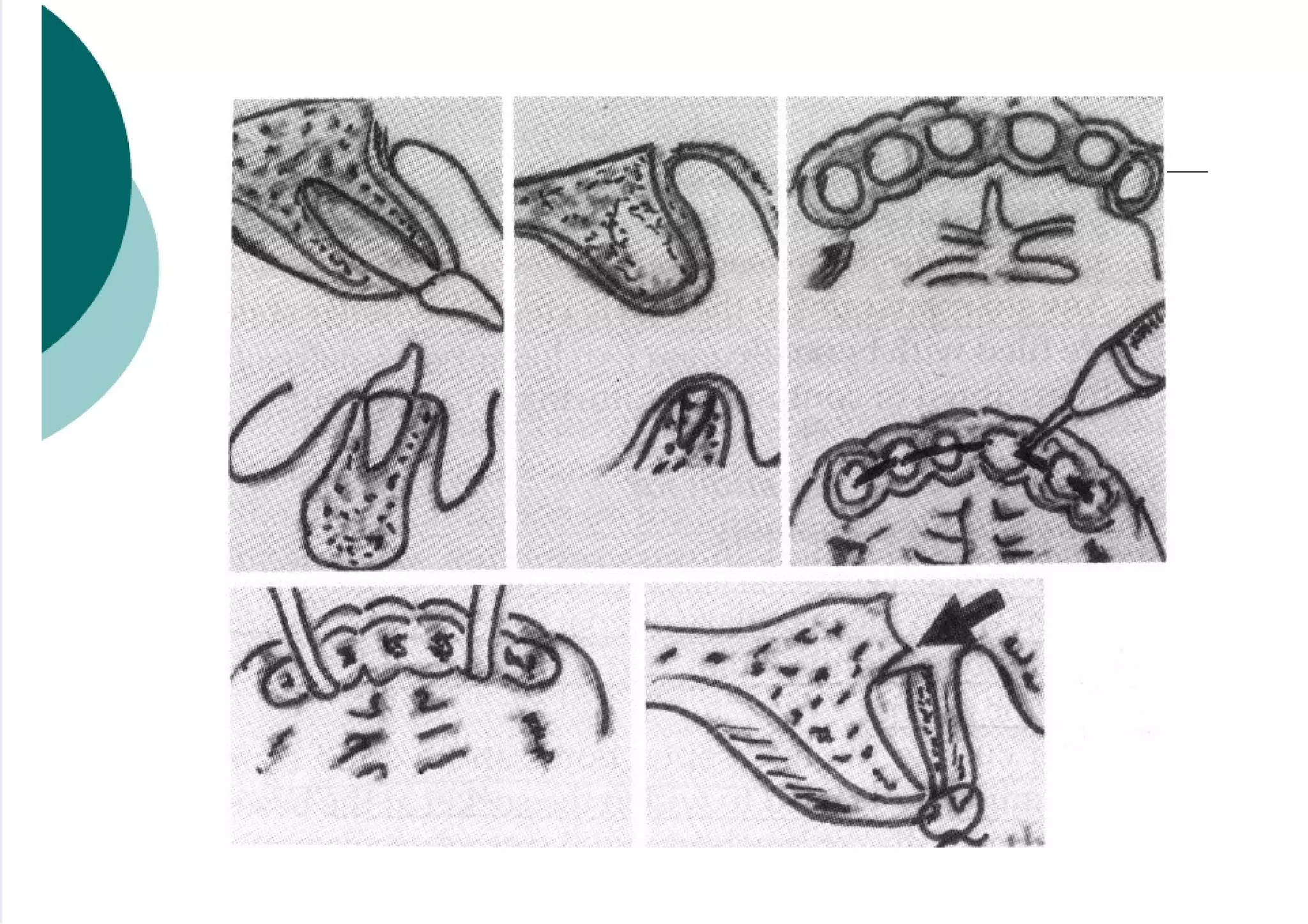 vdocument.in_pre-prosthetic-surgeryppt.pdf