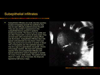 vdocument.in_corneal-graft-rejection-and-graft-failure.ppt