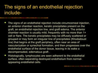 vdocument.in_corneal-graft-rejection-and-graft-failure.ppt