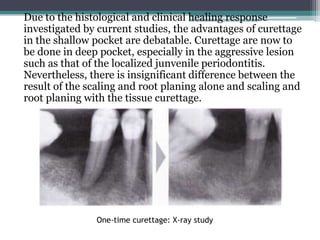 vdocuments.net_surgical-periodontal-therapy-56ebcbc25be52.ppt | Oral ...