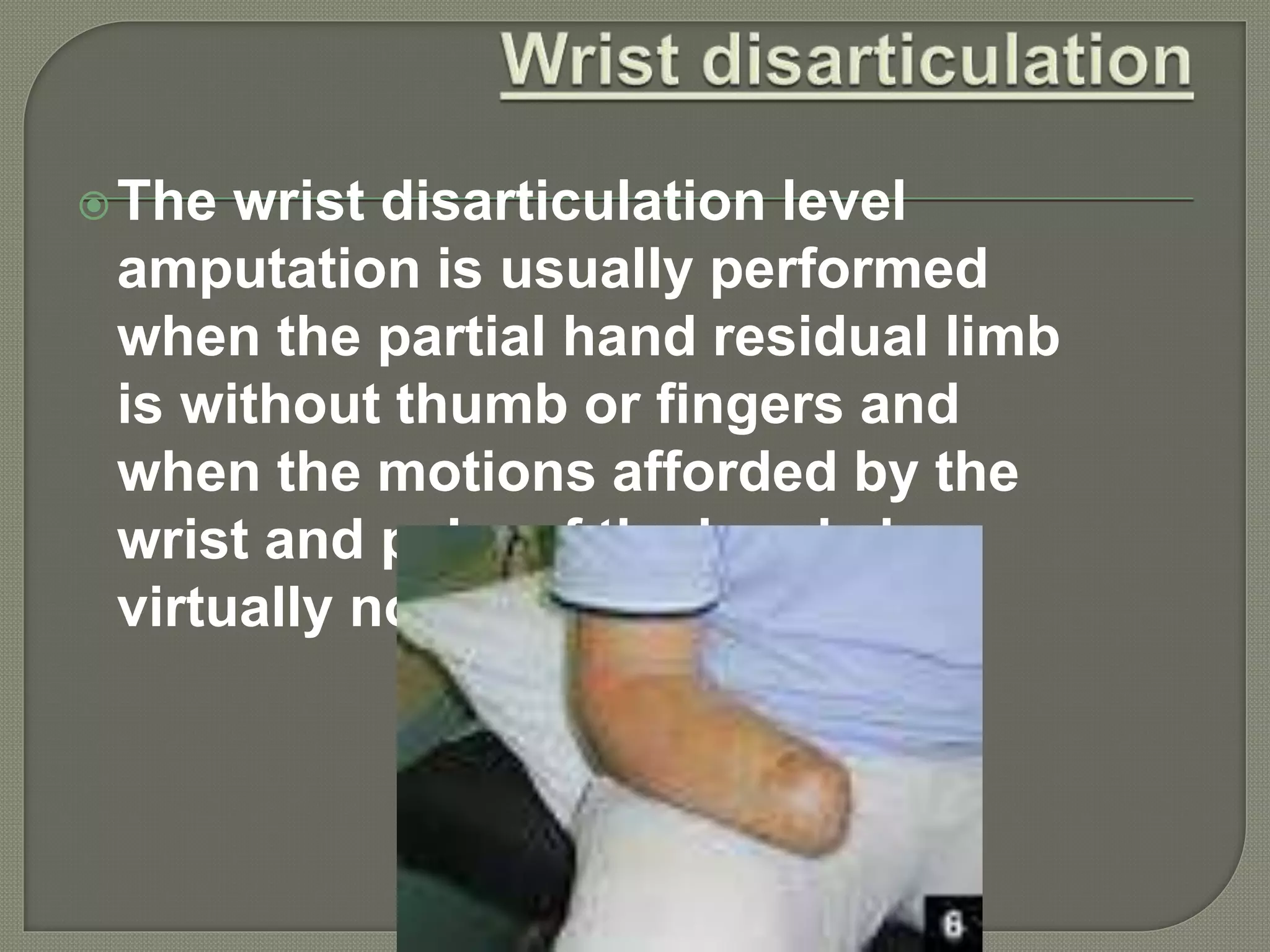 vdocuments.net_upper-limb-prosthesis.pptx