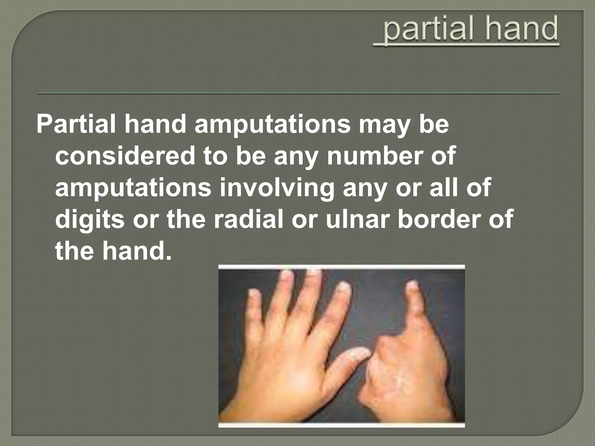 vdocuments.net_upper-limb-prosthesis.pptx