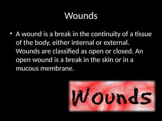 mapeh-9health-on-wounds quarter four grade9 | PPTX