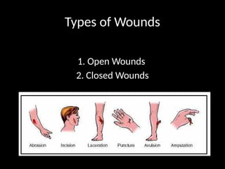 mapeh-9health-on-wounds quarter four grade9 | PPT