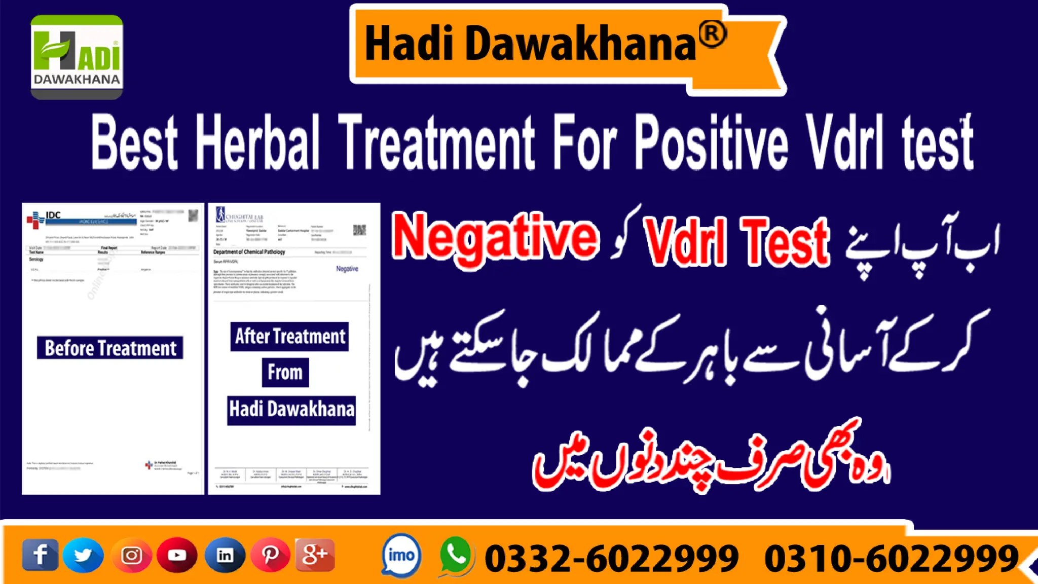 Vdrl treatment ka ilaj | Positive vdrl ka ilaj | Hadi Dawakhana | PDF