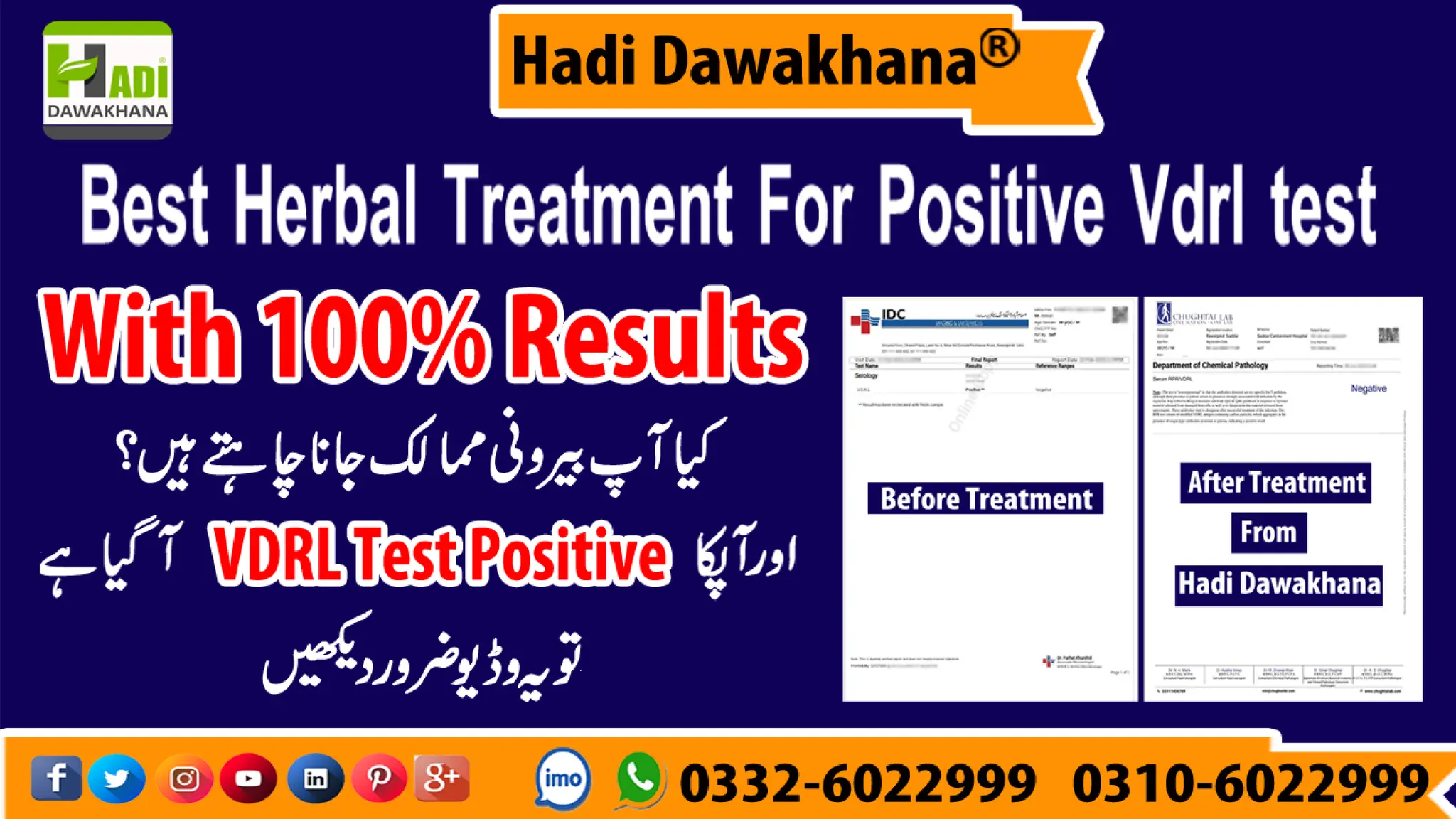 Vdrl test negative karny ka tarika | Positive vdrl ka ilaj | Hadi ...