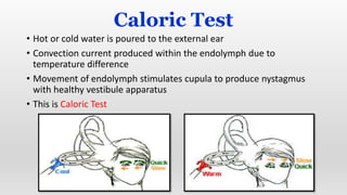 Vestibular apparatus involved in balancing and hearing process | PPTX