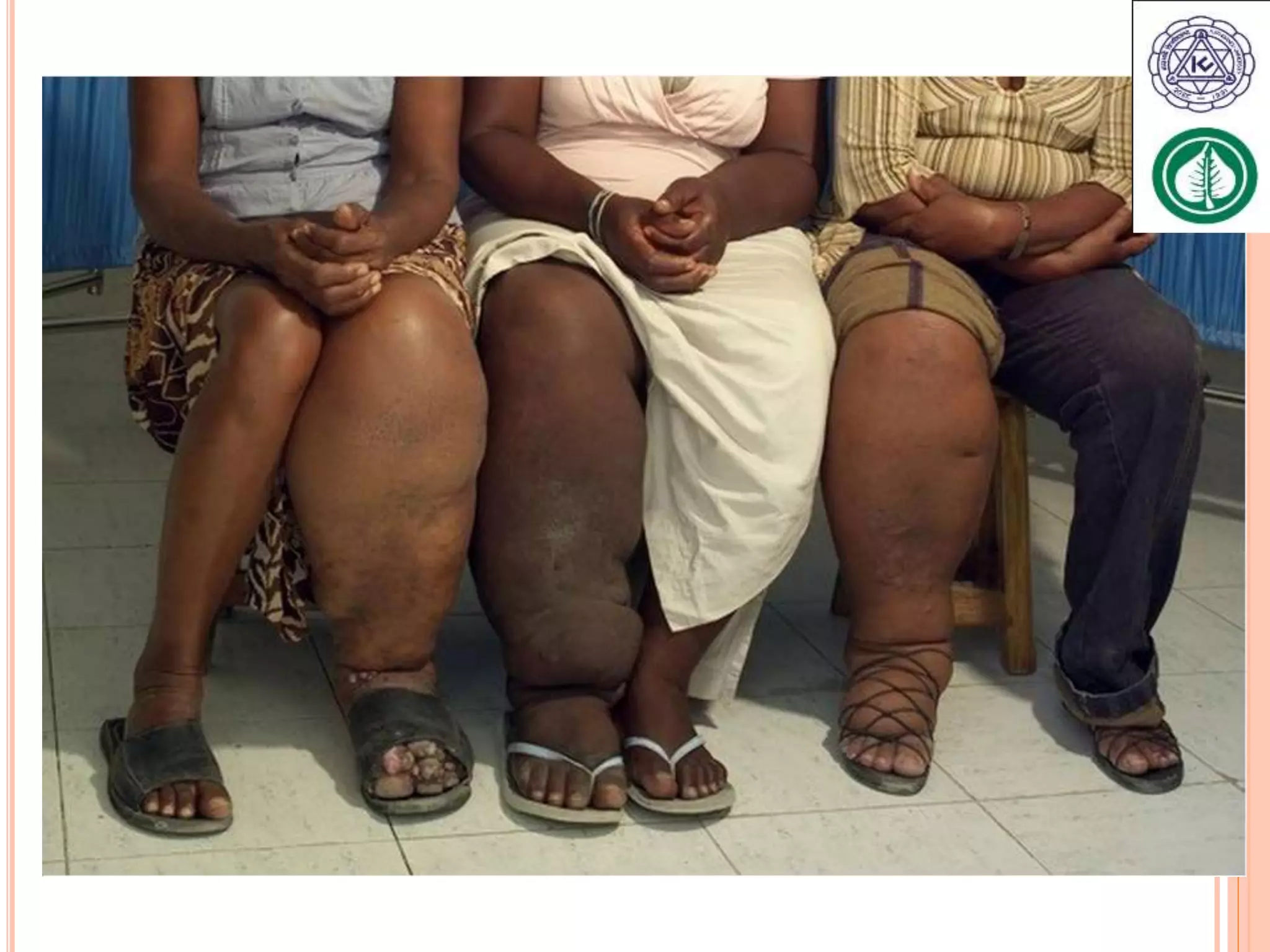 Vector borne disease | PPTX