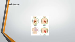 Vector cardiography | PPTX