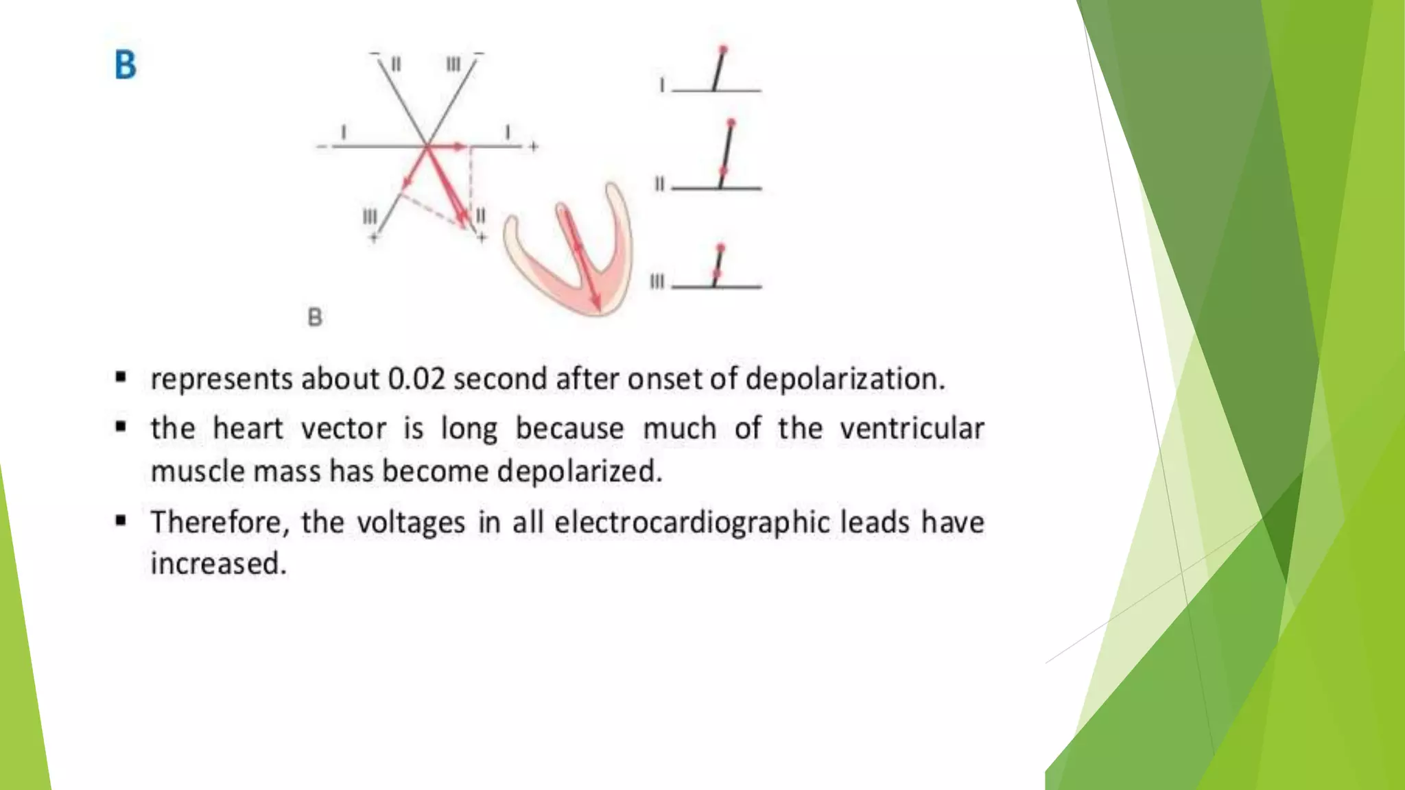 Vectorial analysis of Electrocardiogram | PPTX