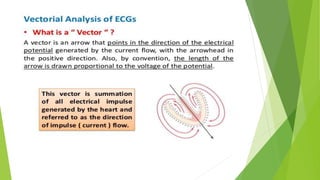 Vectorial analysis of Electrocardiogram | PPTX