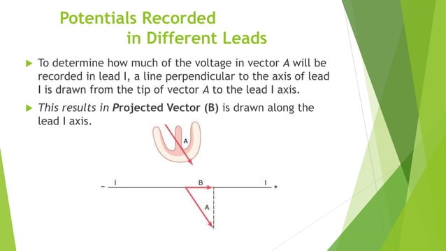 Vectorial analysis of Electrocardiogram | PPTX