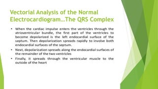 Vectorial analysis of Electrocardiogram | PPTX