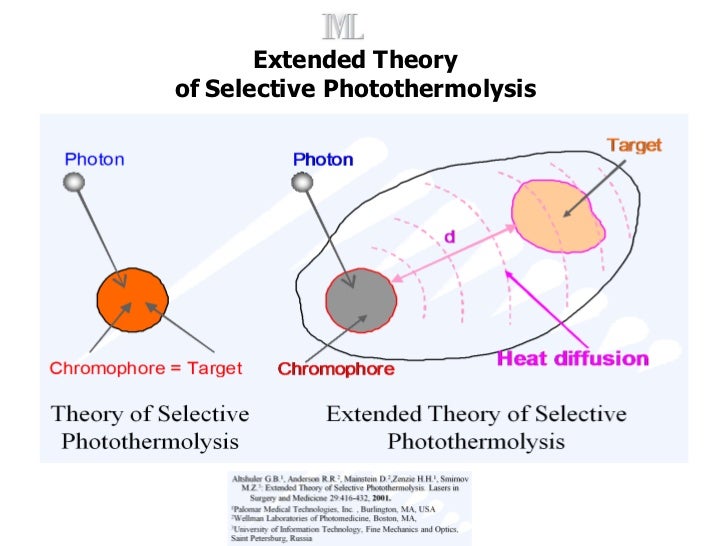 Vectus diode laser iml