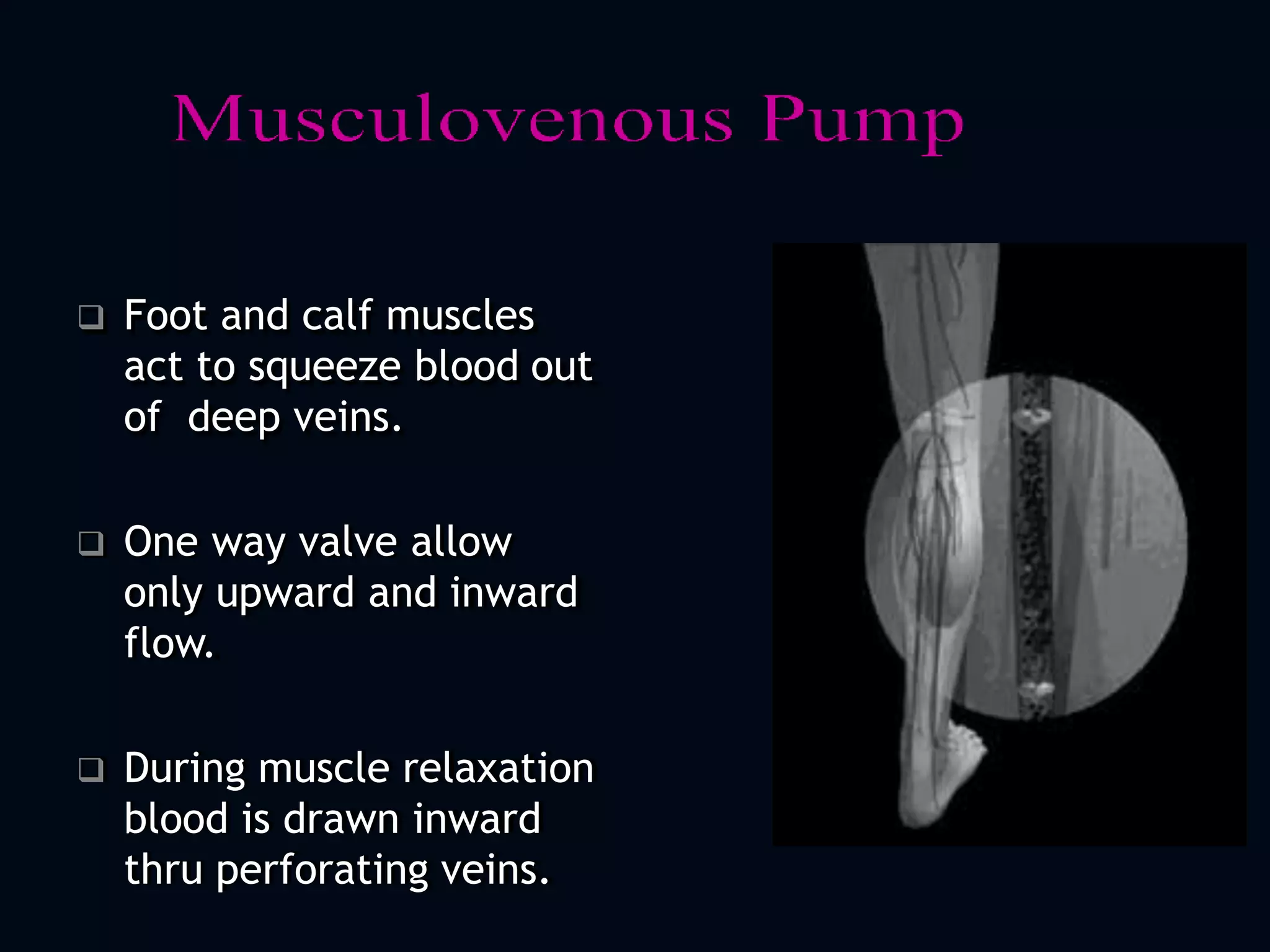 Varicose veins ppt | PPTX